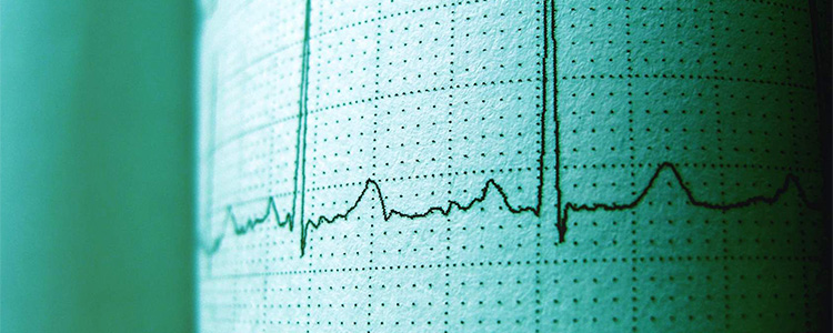 12-Lead ECG Interpretation