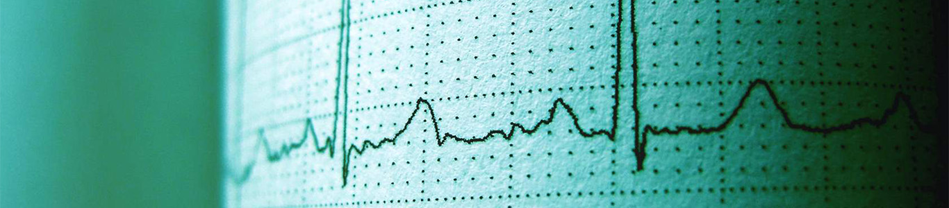 12-Lead ECG Interpretation